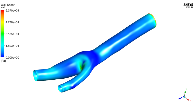 Non-Newtonian Blood in Artery CFD: A Fluent & DPM Tutorial | CFDLAND