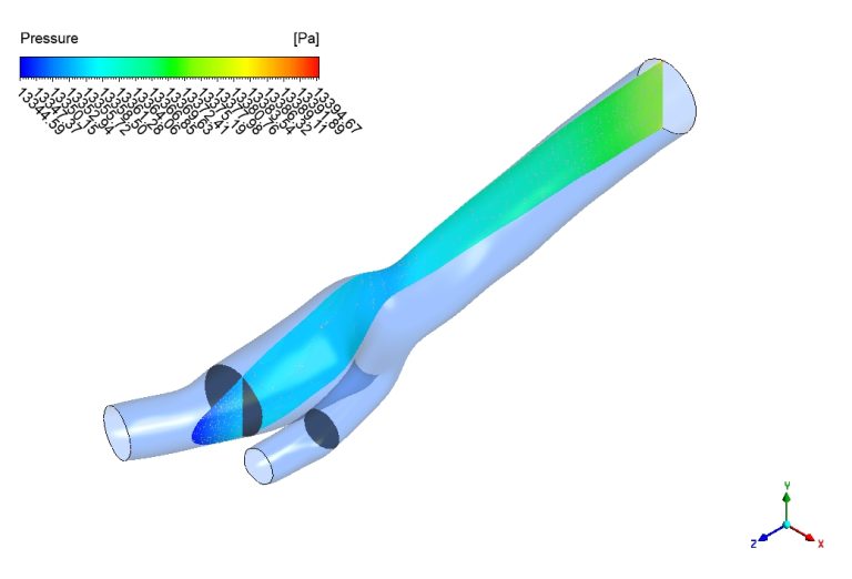 Non-Newtonian Blood in Artery CFD: A Fluent & DPM Tutorial | CFDLAND