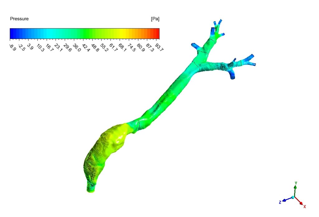 Dry Powder Inhaler CFD: A Fluent DPM Simulation Guide | CFDLAND